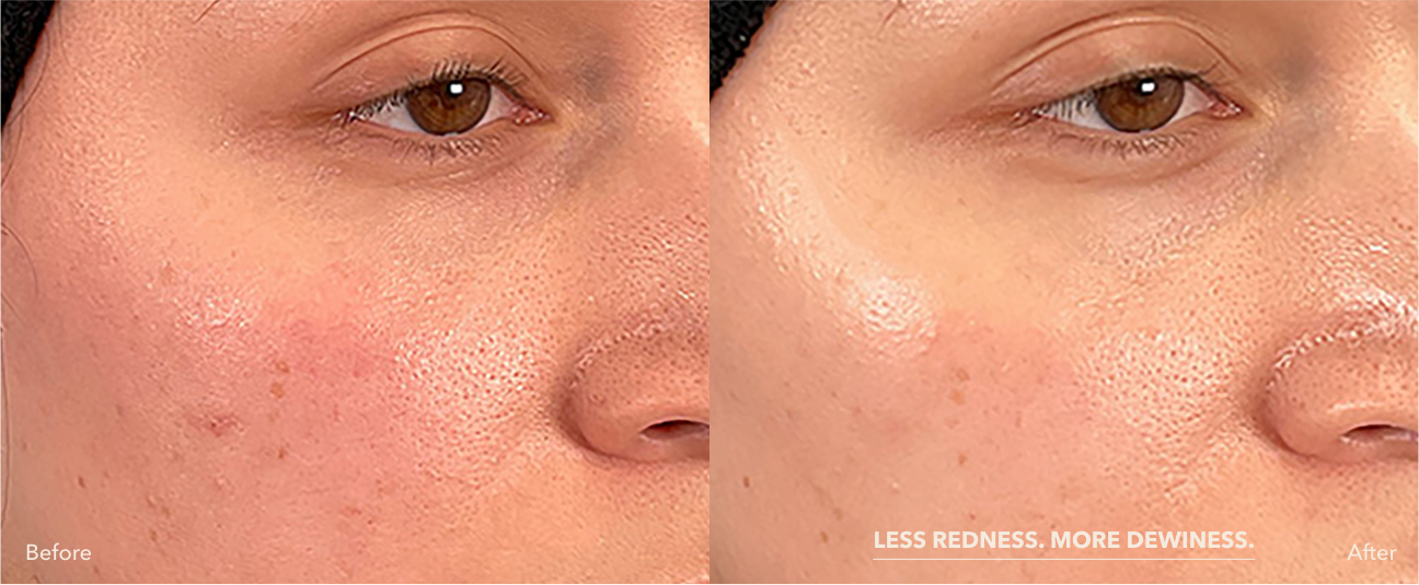 XOMD Arouse Moisturizer - Featuring OX Factor for an Oxytocin-Like Effect in the Skin